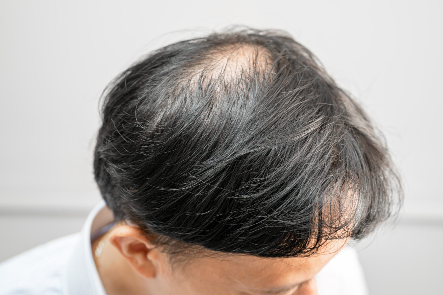 Hair and Nail Disorders | Total Dermatology